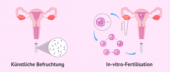 Was ist die Leihmutterschaft? Definition, Arten und Indikationen