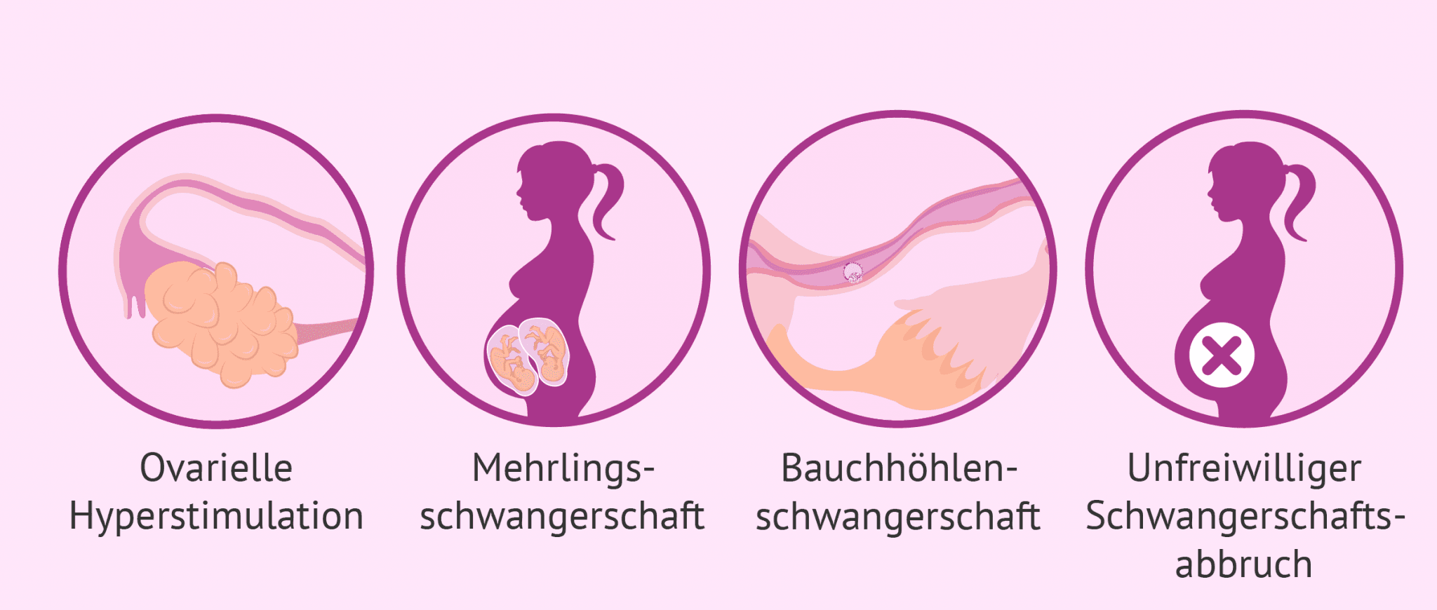 Die In-vitro-Fertilisation (IVF): Indikationen, Ablauf und Kosten