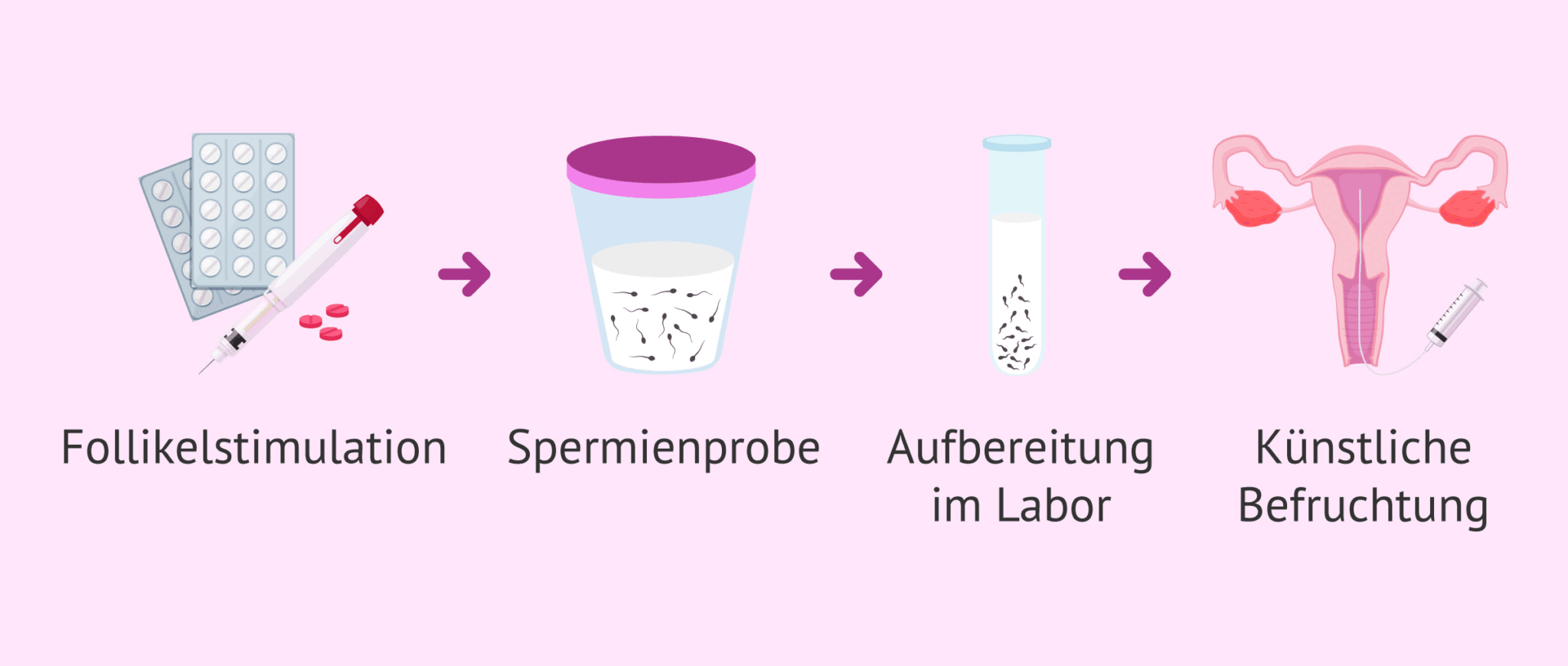 Homologe Insemination: Befruchtung mit Spermien des Partners