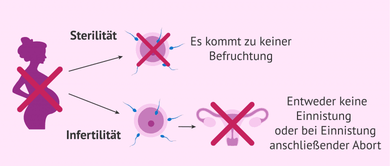 Was Verursacht Weibliche Sterilität Symptome Und Behandlungen
